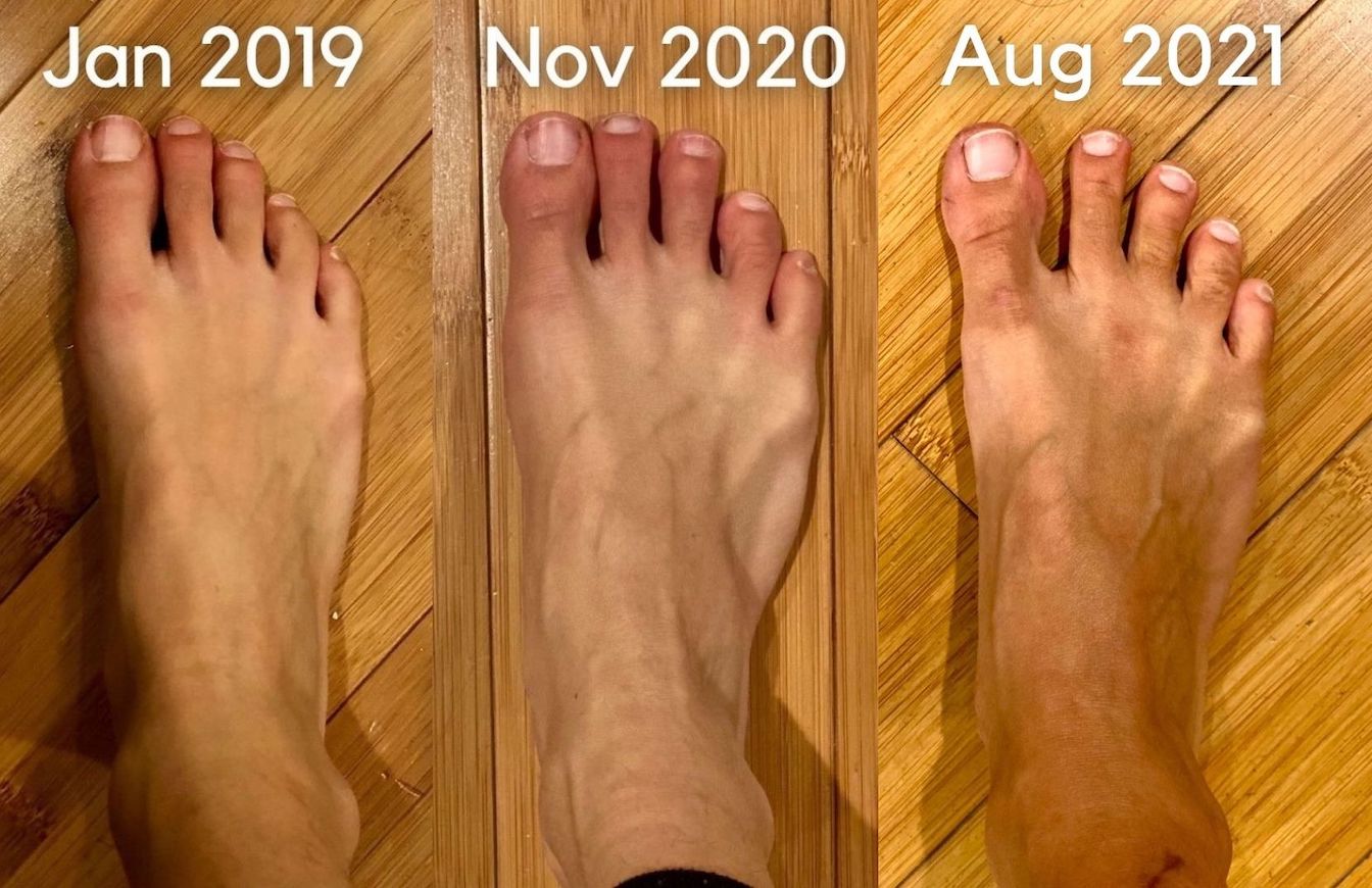 My Journey to Strong Feet & Barefoot Shoes | Anya's Reviews