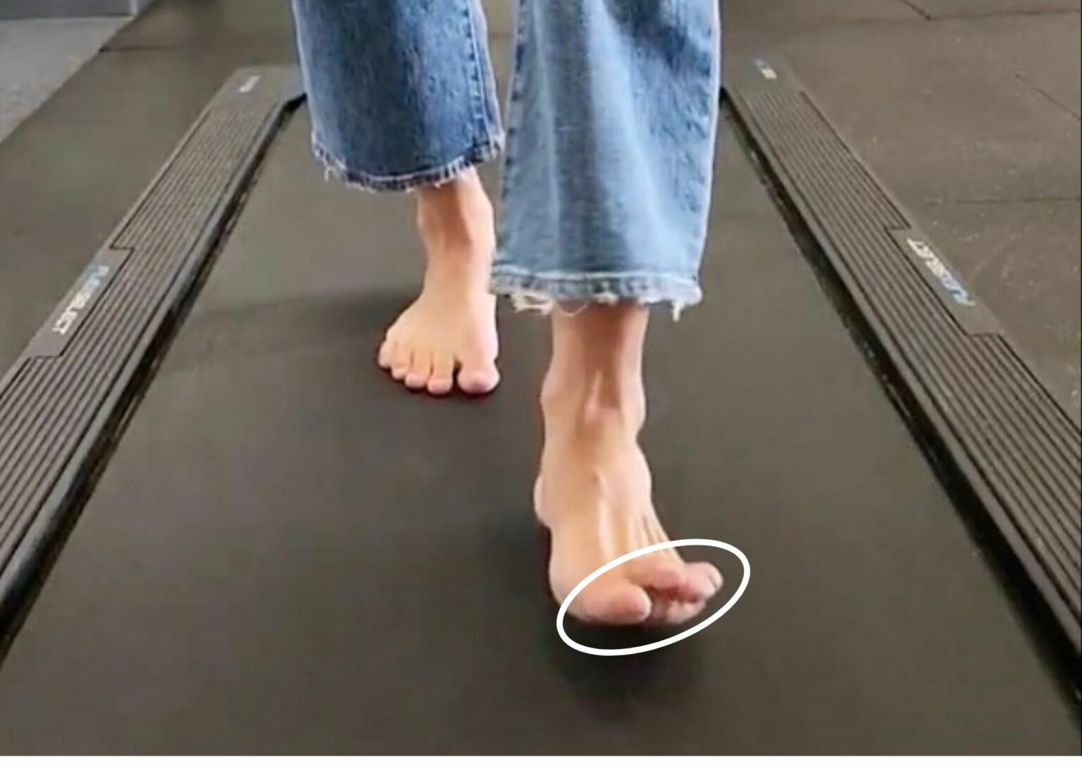 Findings From a Gait Analysis - How to Move Without Pain | Anya's Reviews